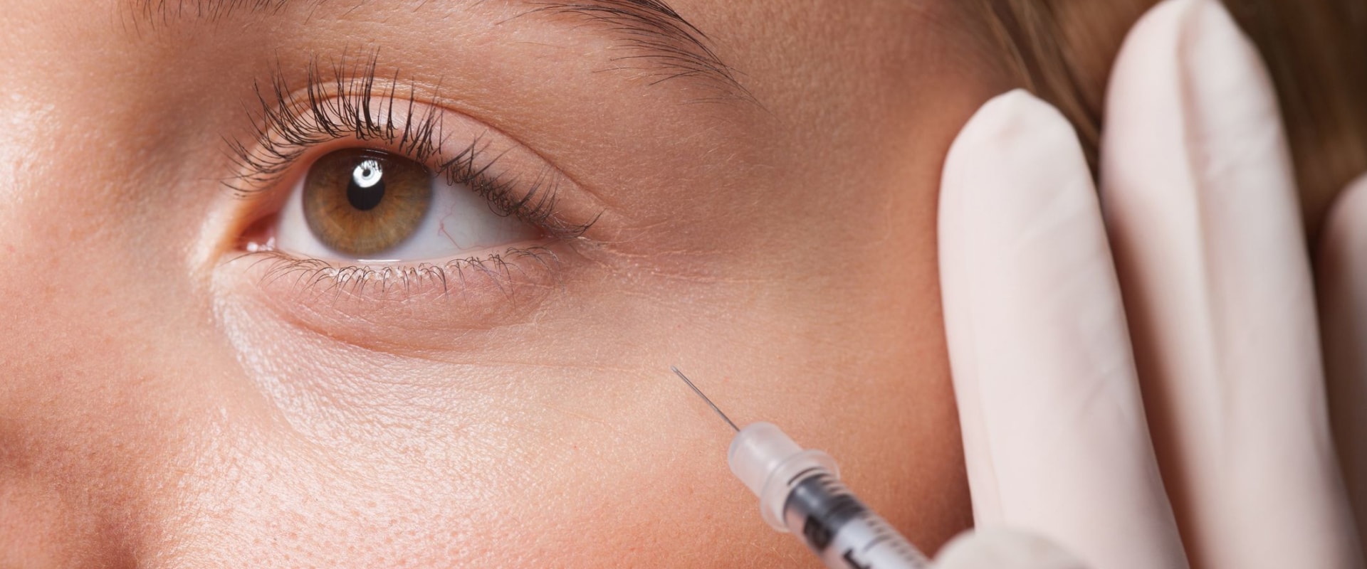 Everything You Need to Know About Botox Injections